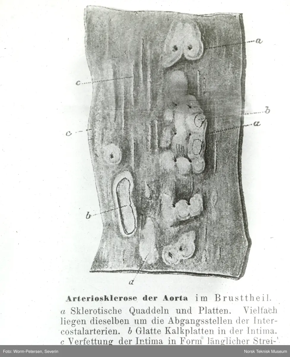 Pubertetsutvikling hos gutter, skjema - Norsk Teknisk Museum ...