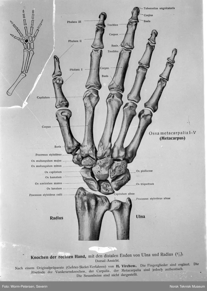 Knokler, høyre hånd - Norsk Teknisk Museum / DigitaltMuseum